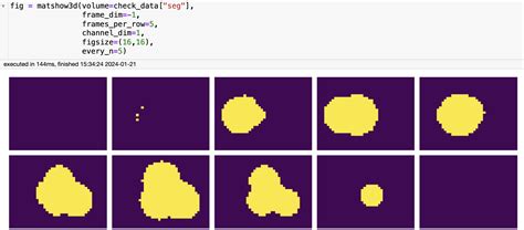 从三维图像中抽取2d样本进行训练 Monai实战医学3d数据下采样成2d图片一般有哪些方法 Csdn博客