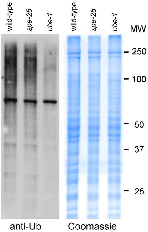 Western Blot For Ubiquitin Panel On The Left Anti Ub Shows The