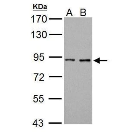 Anti Prothrombin Antibody A41525