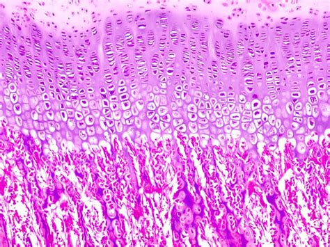 Resting At Top Proliferating Has Multiple Chondrocytes In Lacunae Hypertrophic Has Huge