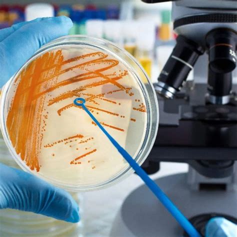 Microbiology Testing Labs At ₹ 1500sample In Chennai Id 2855291780930