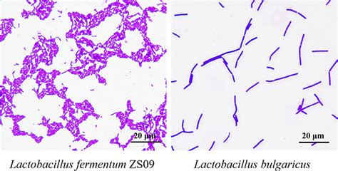 Lactobacillus Fermentum Zs09 Mediates Epithelial Mesenchymal Jir