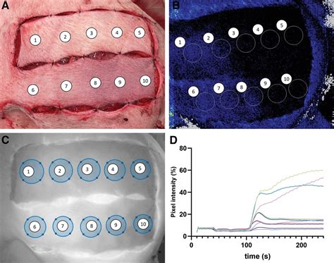 Correlation Between Indocyanine Green Fluorescence Angiograp