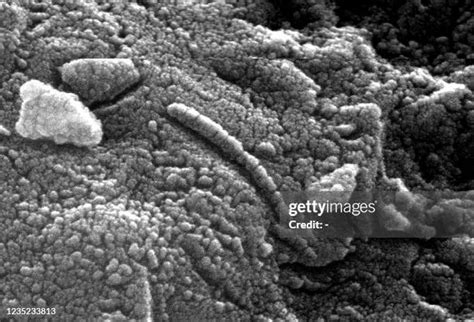 Human Hair Under Electron Microscope Human Hair Under Electron Microscope