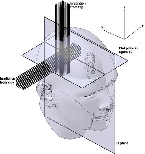 Irradiation Geometry For Two Orthogonally Interlaced Pencil Beam Array