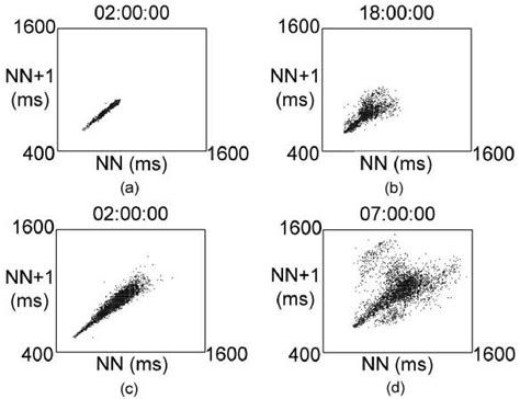 Figure 4 From Review Article Non Linear Heart Rate Variability And Risk Stratification In