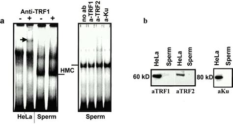 Somatic Telomere Binding Proteins Are Absent In Hstbptr A Crude