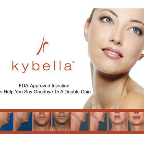 Best Belkyra Kybella Treatment Los Angeles Aqualyx Fat Dissolving