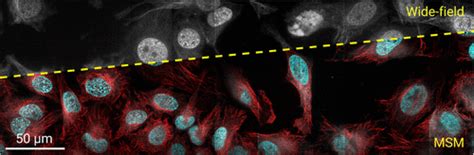 Simultaneous Multicolor Multifocal Scanning Microscopy Acs Photonics