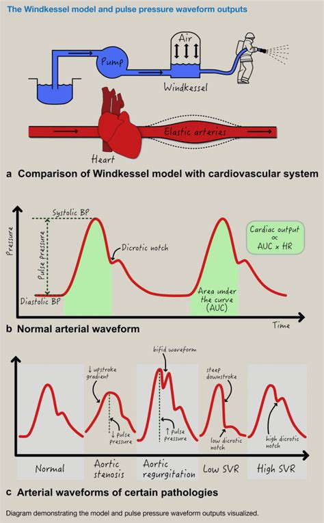 Cardiac Output Diagram