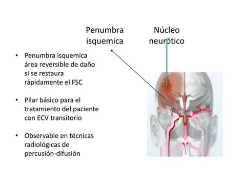 Enfermedad Cerebrovascular Ppt
