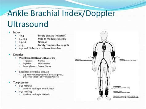 Ankle Brachial Index