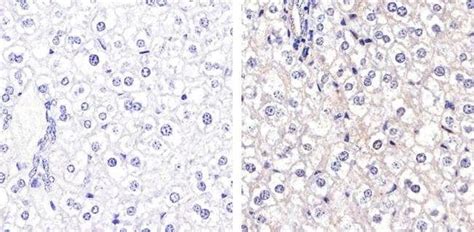 Connexin 26 Polyclonal Antibody Invitrogen 50 μg Unconjugated