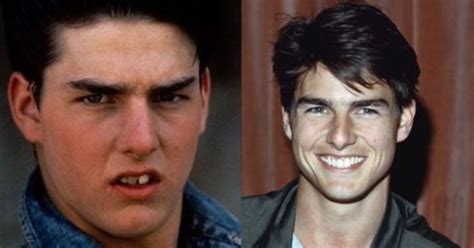 Tom Cruise Teeth Usa S Top Trending Topic