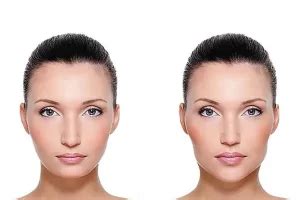 Cl Nica Fl Via Freitas Dermatologia E Tricologia Bh Mg