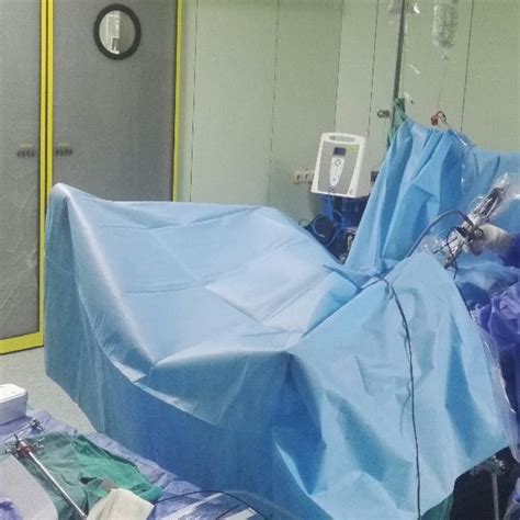 Retrograde View Of Resected Prostate A Resected Right Lateral Lobe