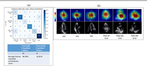 Figure 5 From Classification Of Echocardiogram View Using A