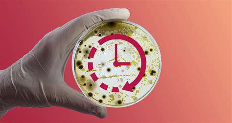 3 Day Turnaround Time For Total Viable Count Tvc And Colony Count Cc