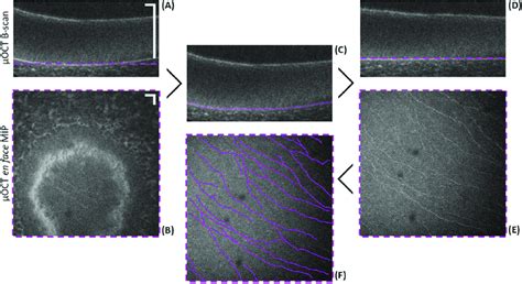 Illustration Of Image Segmentation Procedure To Extract The SBP In A