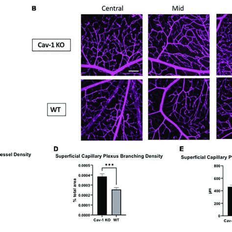 Analysis Of Superficial Capillary Plexus Morphology A
