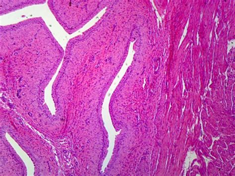Prepared Microscope Slide Transitional Epithelium Mammalian Stratified Cuboidal Epithelium