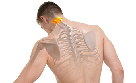 HWS Syndrom Und Schmerzen Im Nacken Lassen Sich Leicht Beheben