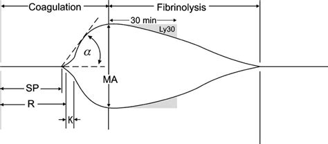 Figure 1 From Cardiopulmonary Bypass And The Coagulation System Semantic Scholar
