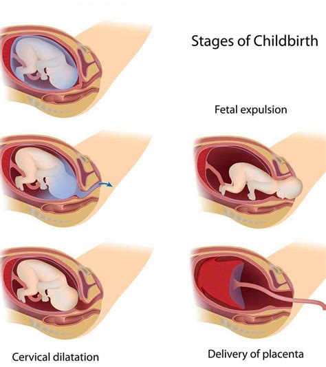 Stages Of Labor