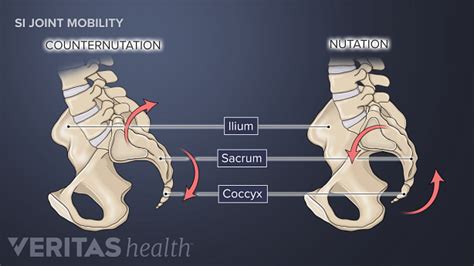 Sacroiliac Joint Dysfunction