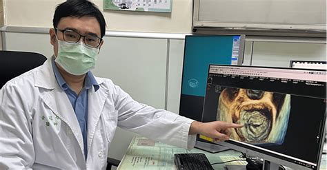 3D立體心臟超音波 讓自己看見跳動中心臟
