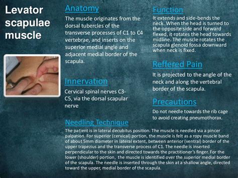 Trigger Point Dry Needling