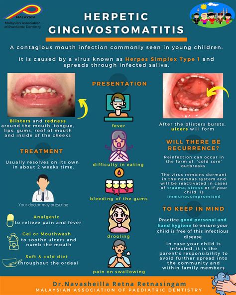 Gingivitis Vs Stomatitis At Kevin Broadway Blog