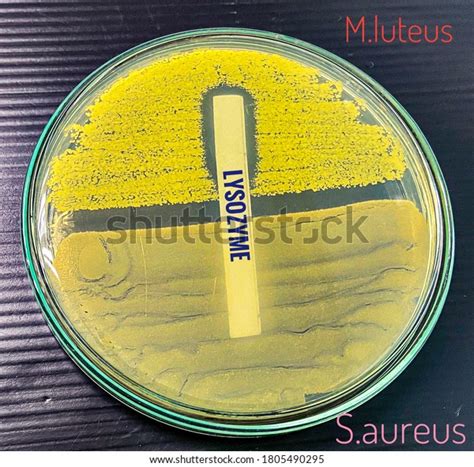 Antibacterial Activity Lysozyme Micrococcus Luteus Staphylococcus Stock