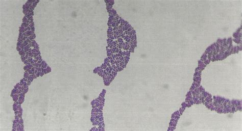 Positive Gram Stain Micrococcus Luteus Image Tim Sandle Download