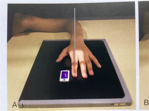 Upper Extremity Positioning Flashcards Quizlet