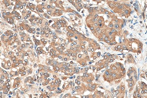 Eef1a1 Antibody 11402 1 Ap Proteintech