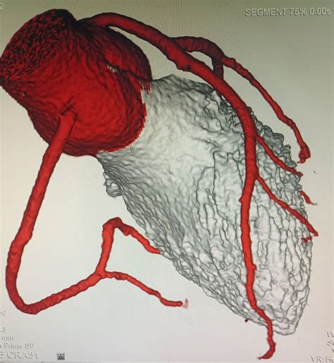 Ekg Central 🔰 Ekg Review 🔰 🔗 Struggling With Ekg Rhythms