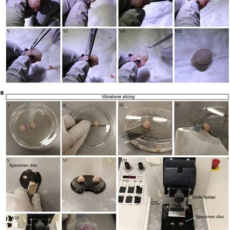 Mouse Brain Dissection And Vibratome Slicing Of Ex Vivo Organotypic