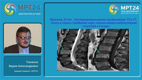 МРТ в диагностике объемных образований позвоночника и спинного мозга