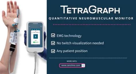 Quantitative Emg Monitor Archives The Anesthesia Consultant