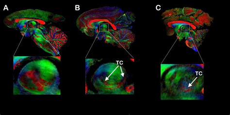 Non Human Primate Comparative Thalamic Commissures Diffusionencoded