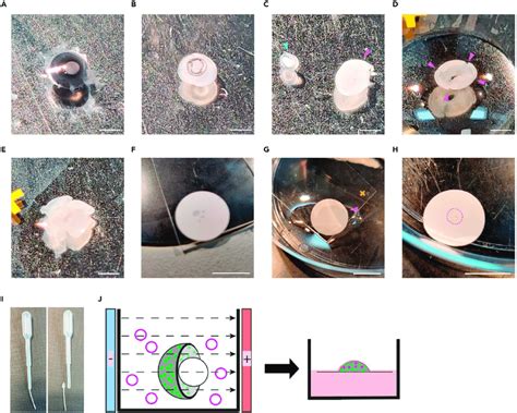 Retinal Dissection And Tissue Handling A Enucleated Eye From A P0