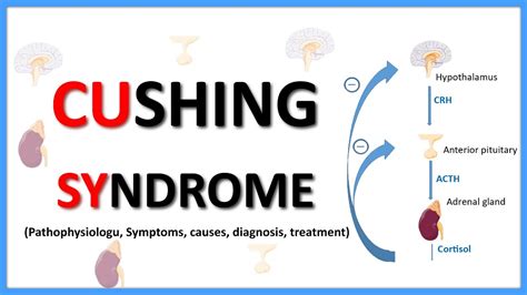 How Does Cushing S Disease Make You Feel At Adam Ross Blog