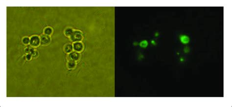 Detection Of Gfp Expression In P Pastoris Left P Pastoris Cells