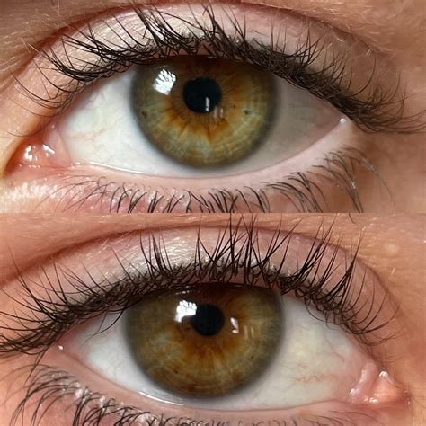 Central Heterochromia Brown And Hazel