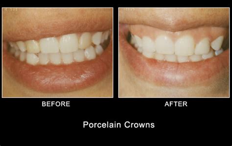 Beverly Hills Ca Dentist