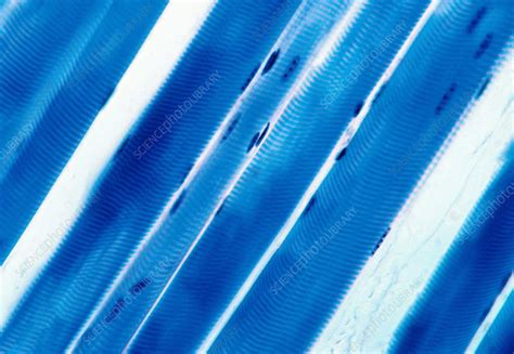 Human Striated Muscle Lm Stock Image C0176074 Science Photo Library