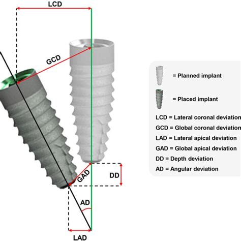 Positional Deviations Between The Planned And Placed Implants Download Scientific Diagram