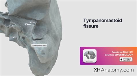 Temporal Bone Tympanomastoid Fissure Youtube