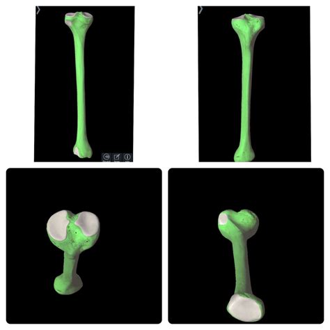 Tibia Diagram Quizlet